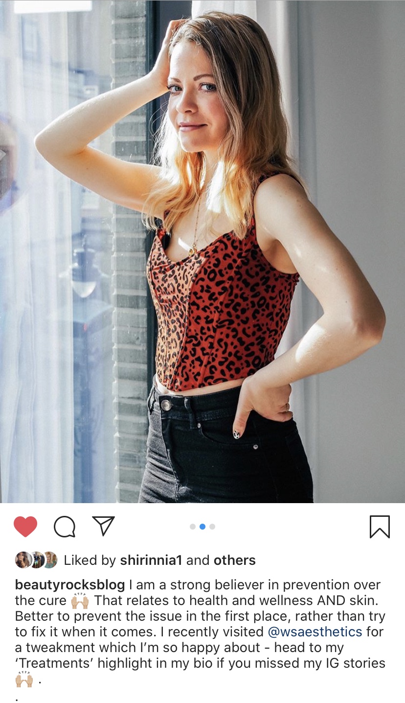 Celebs Swans - White Swan Aesthetics