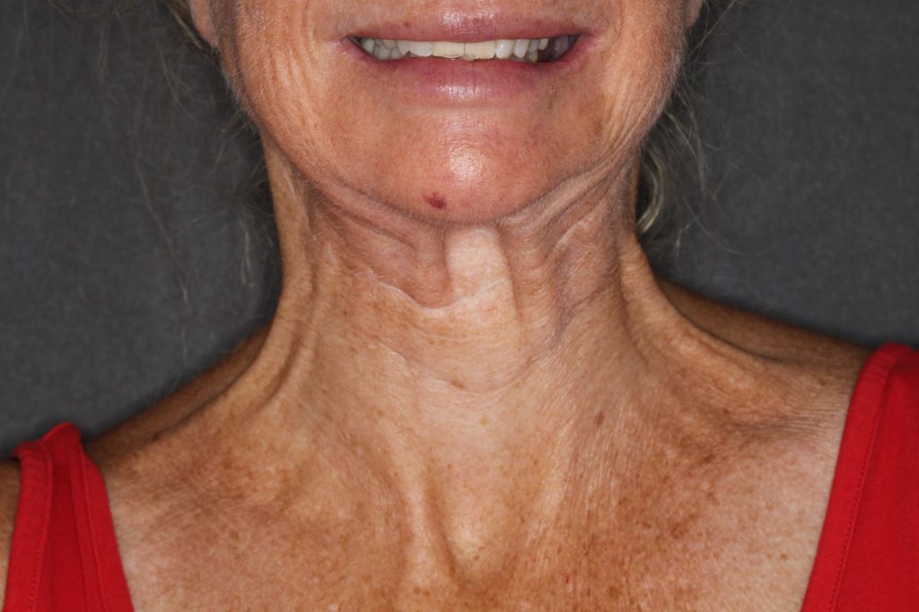 Gallery - White Swan Aesthetics