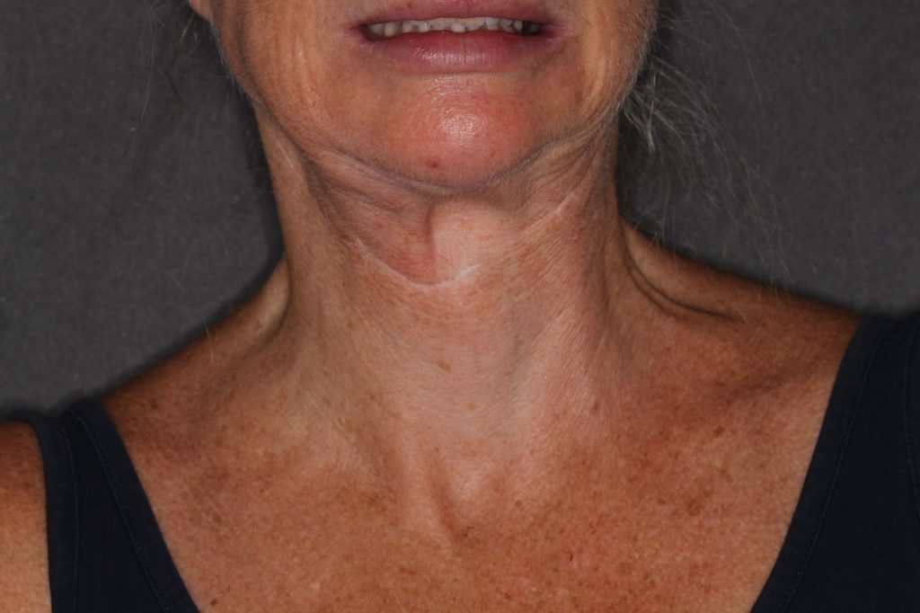 Gallery - White Swan Aesthetics