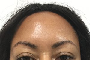 Gallery - White Swan Aesthetics