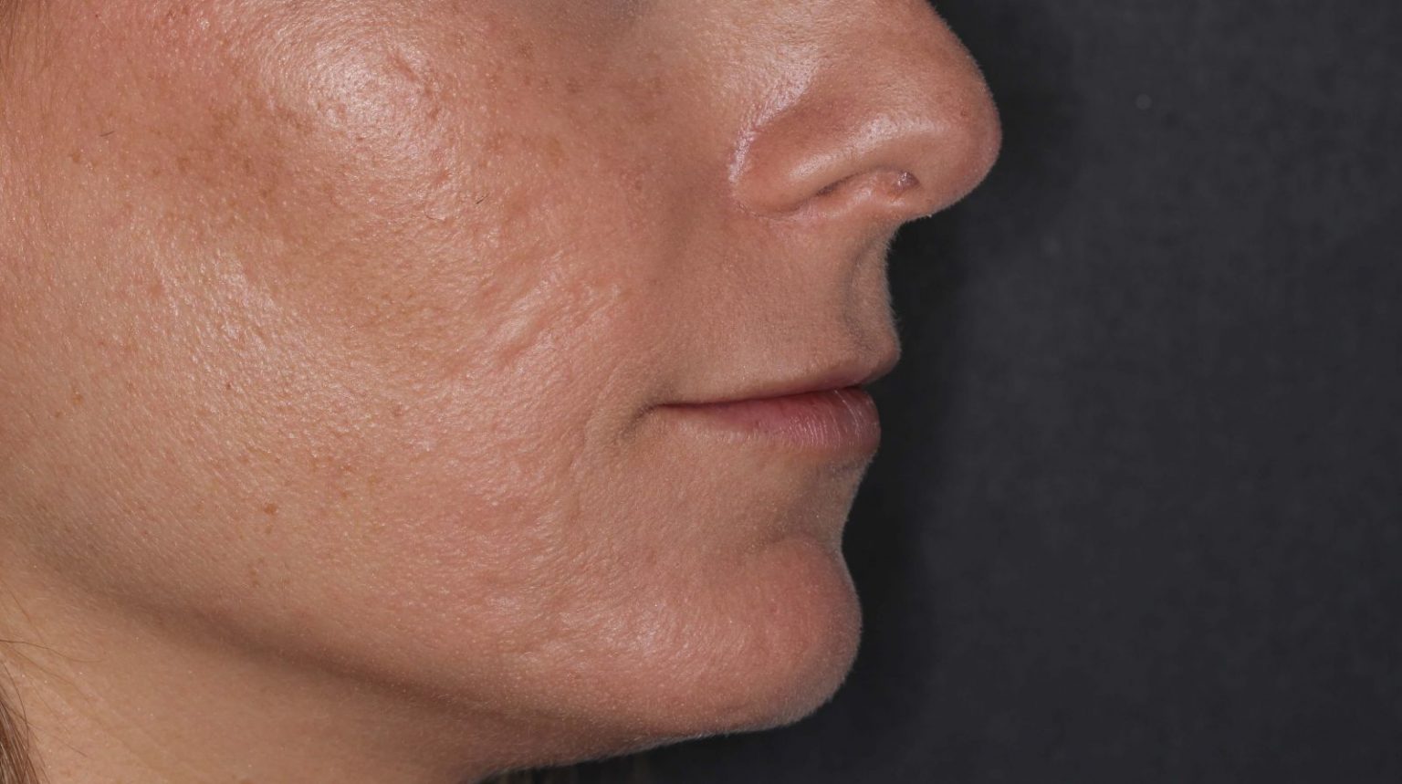 Gallery - White Swan Aesthetics