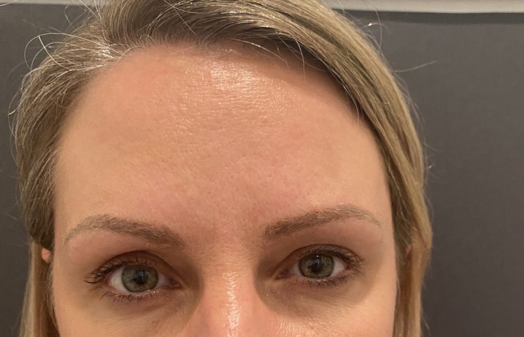 Gallery - White Swan Aesthetics