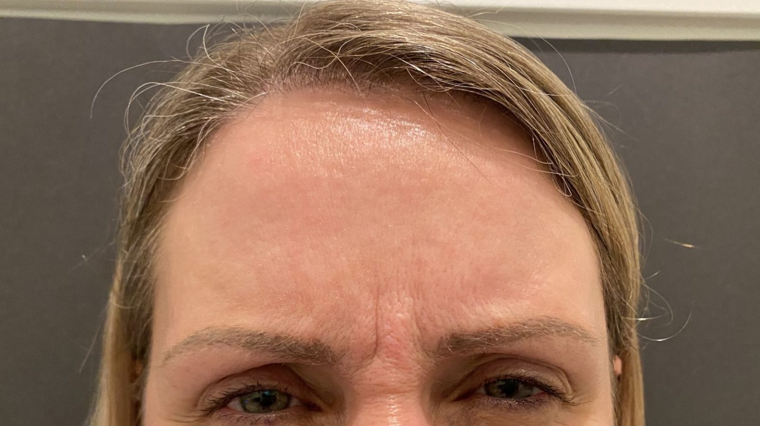 Gallery - White Swan Aesthetics